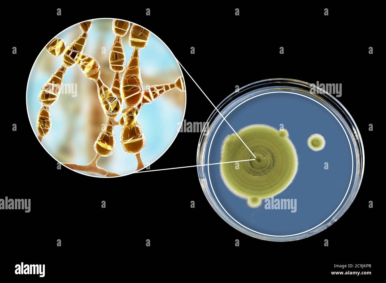 Filamentous allergenic fungus Alternaria alternata, computer ...