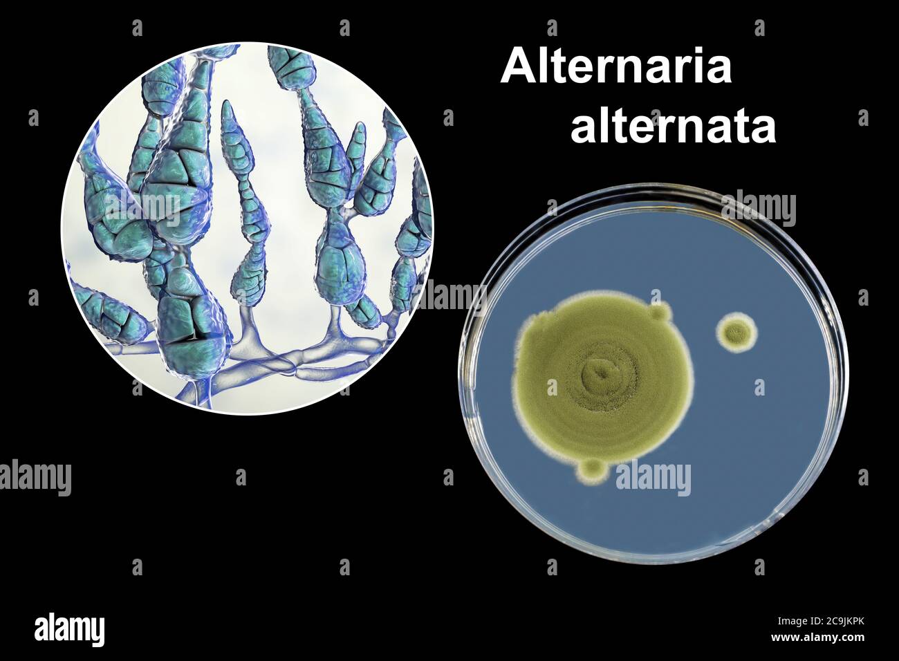 Filamentous allergenic fungus Alternaria alternata, computer ...