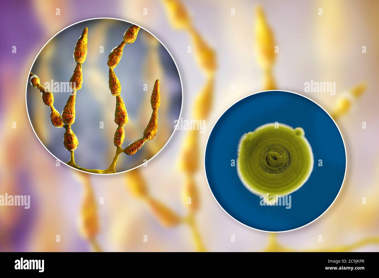 Filamentous allergenic fungus Alternaria alternata, computer ...