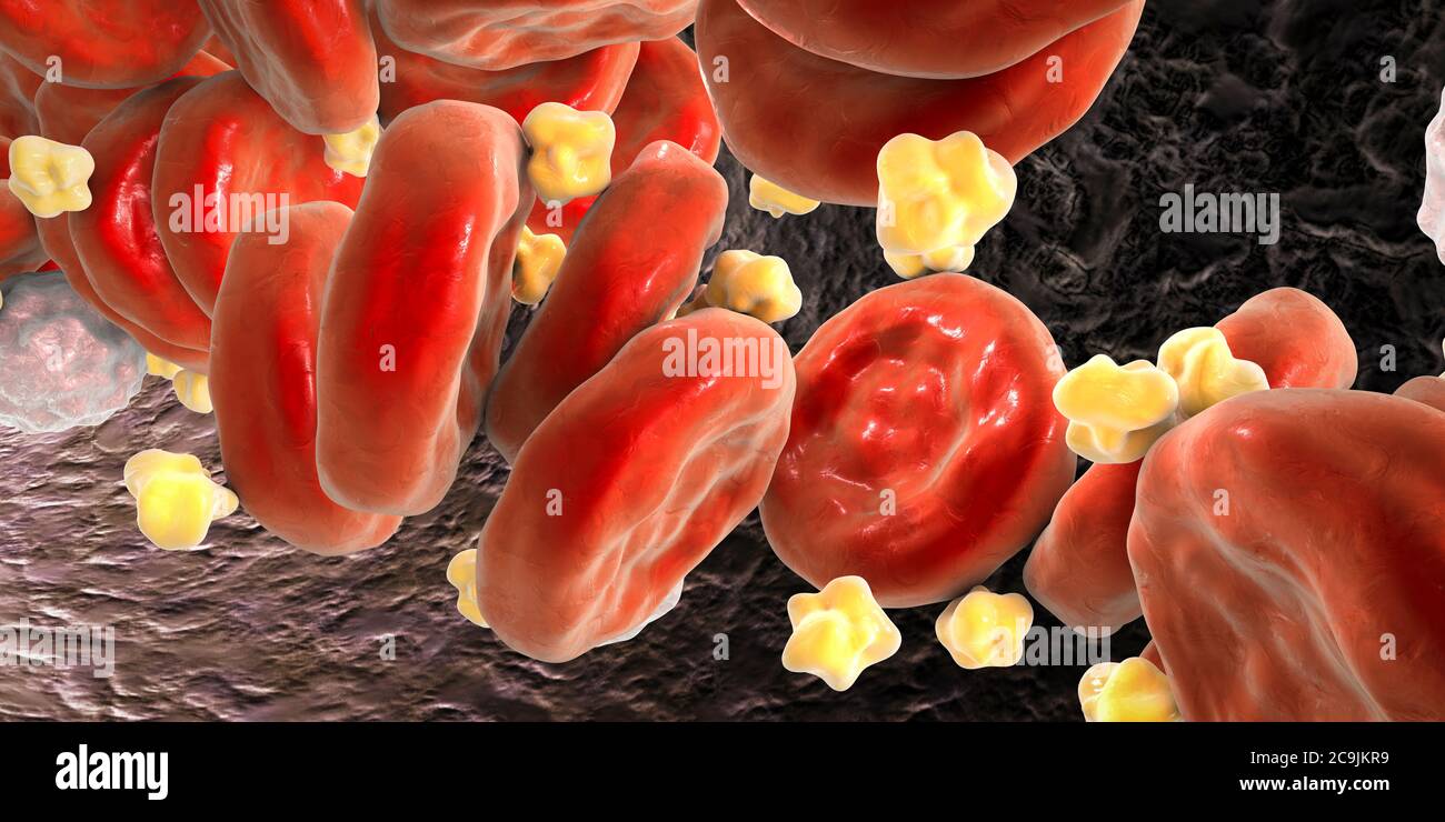 Elevated Blood Lipids
