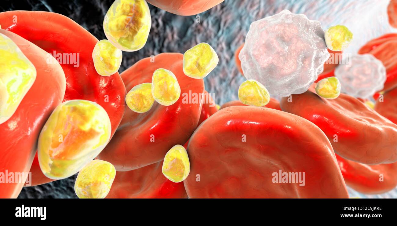 Elevated Blood Lipids