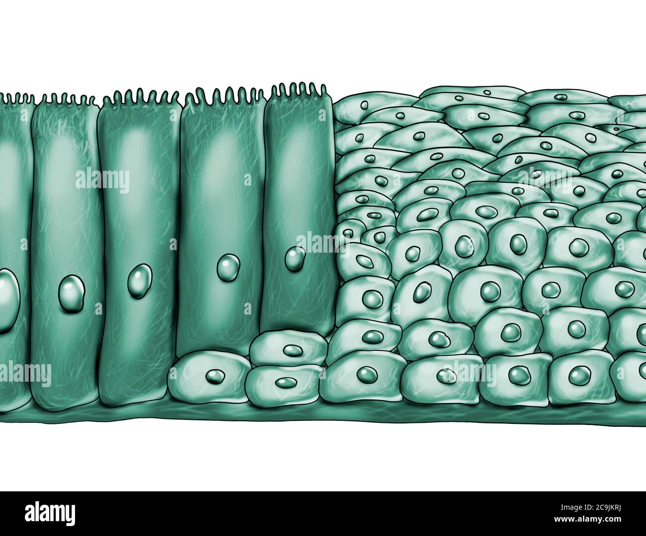 Epithelial metaplasia, computer illustration. Metaplasia is a change of ...