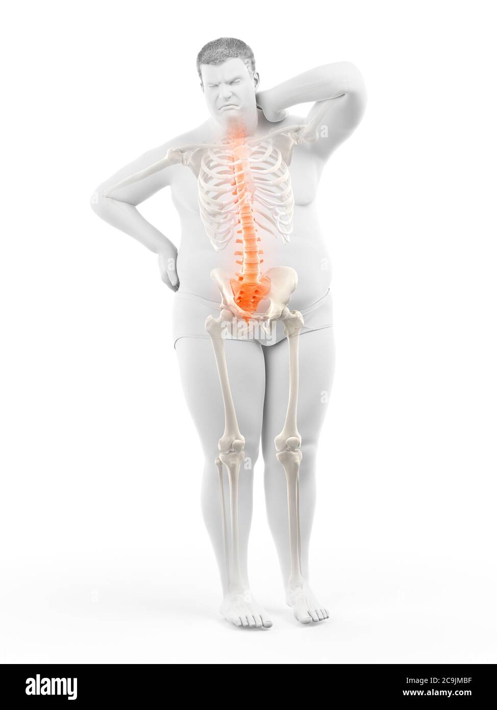 Obese man with back pain, computer illustration Stock Photo - Alamy