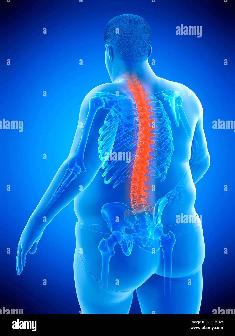 Obese man with back pain, computer illustration Stock Photo - Alamy