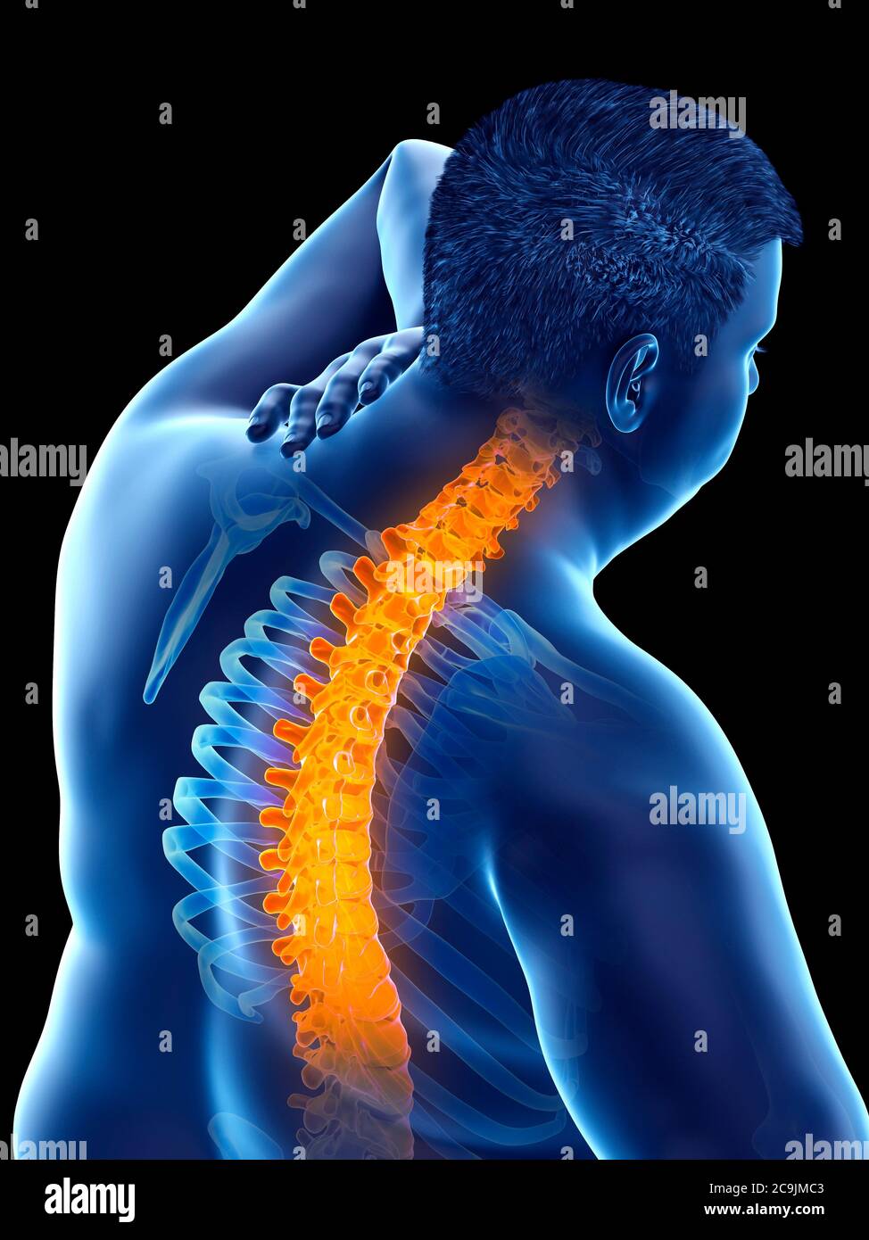 Obese Man With Back Pain High Resolution Stock Photography and Images ...