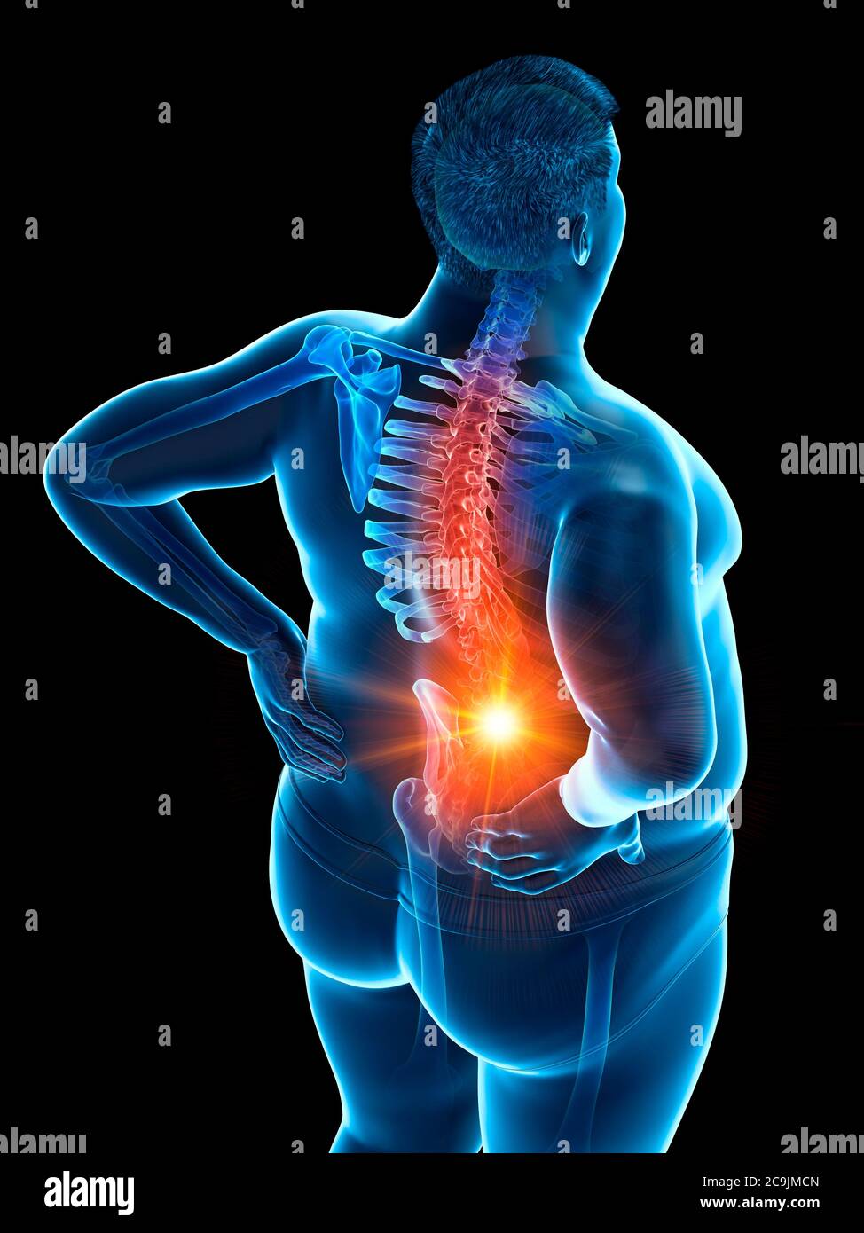 Obese man with back pain, computer illustration Stock Photo - Alamy