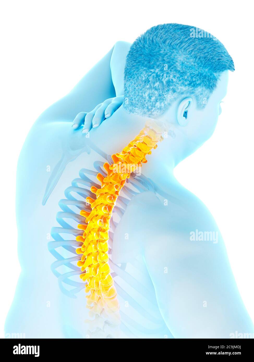 Obese man with back pain, computer illustration Stock Photo - Alamy