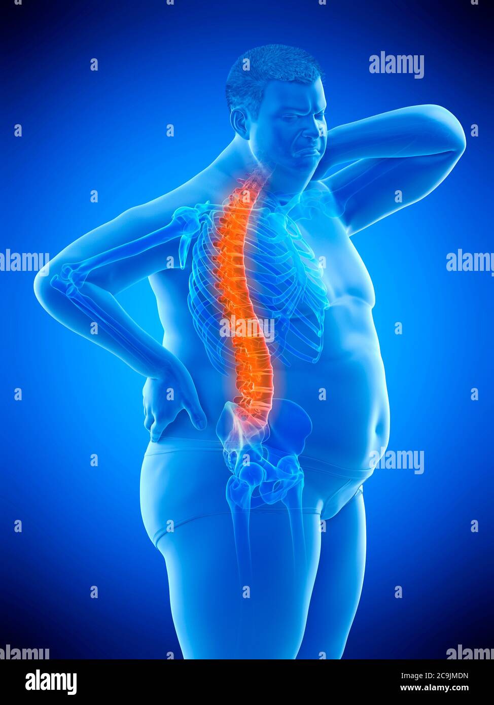 Obese man with back pain, computer illustration Stock Photo - Alamy