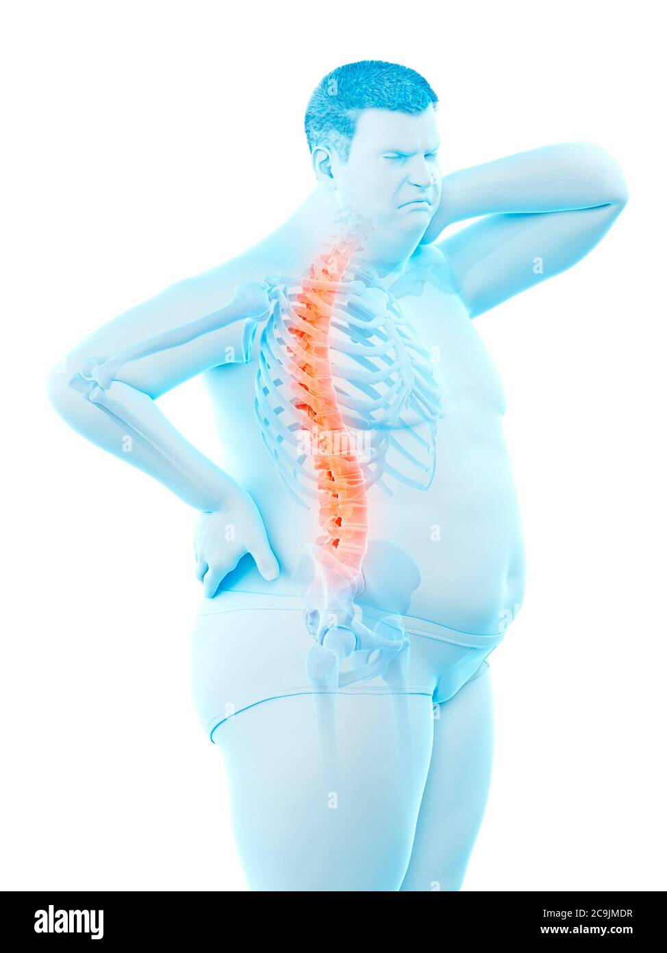 Obese Man With Back Pain High Resolution Stock Photography and Images ...