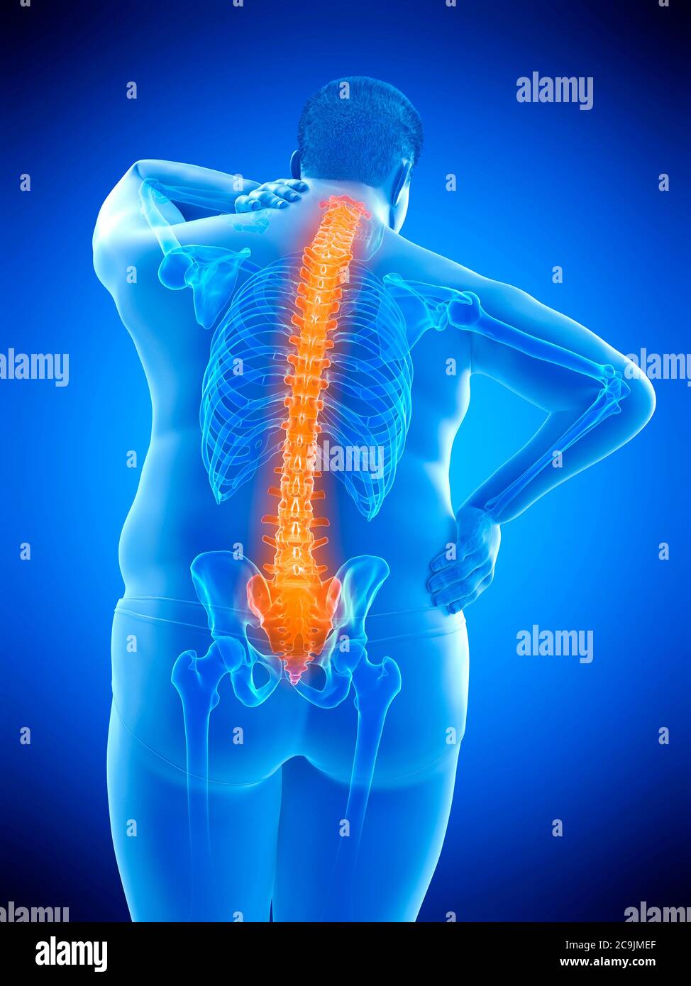 Obese man with back pain, computer illustration Stock Photo - Alamy