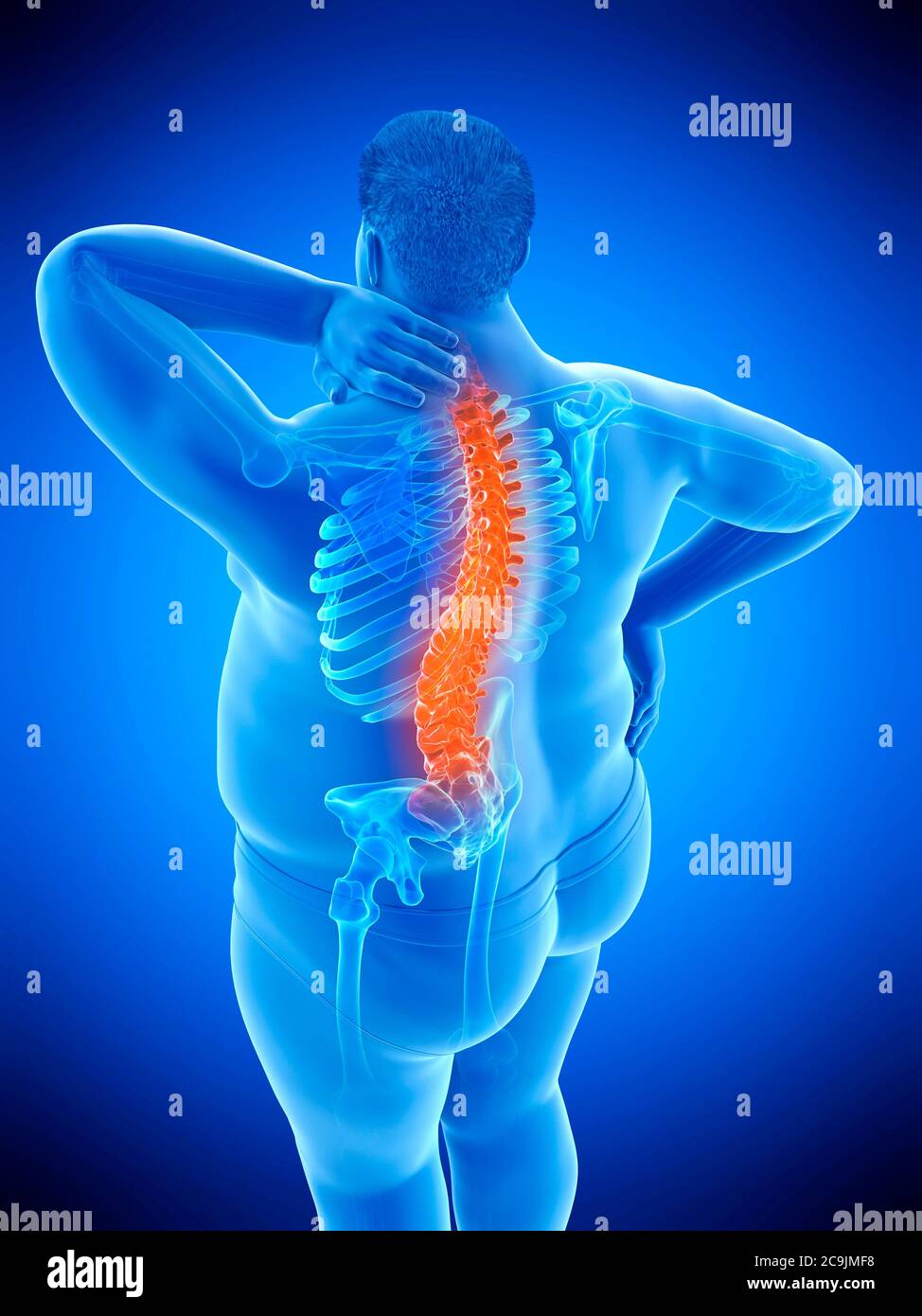 Back of obese man hi-res stock photography and images - Alamy