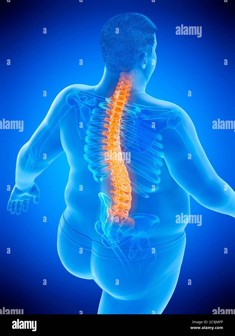 Obese man with back pain, computer illustration Stock Photo - Alamy