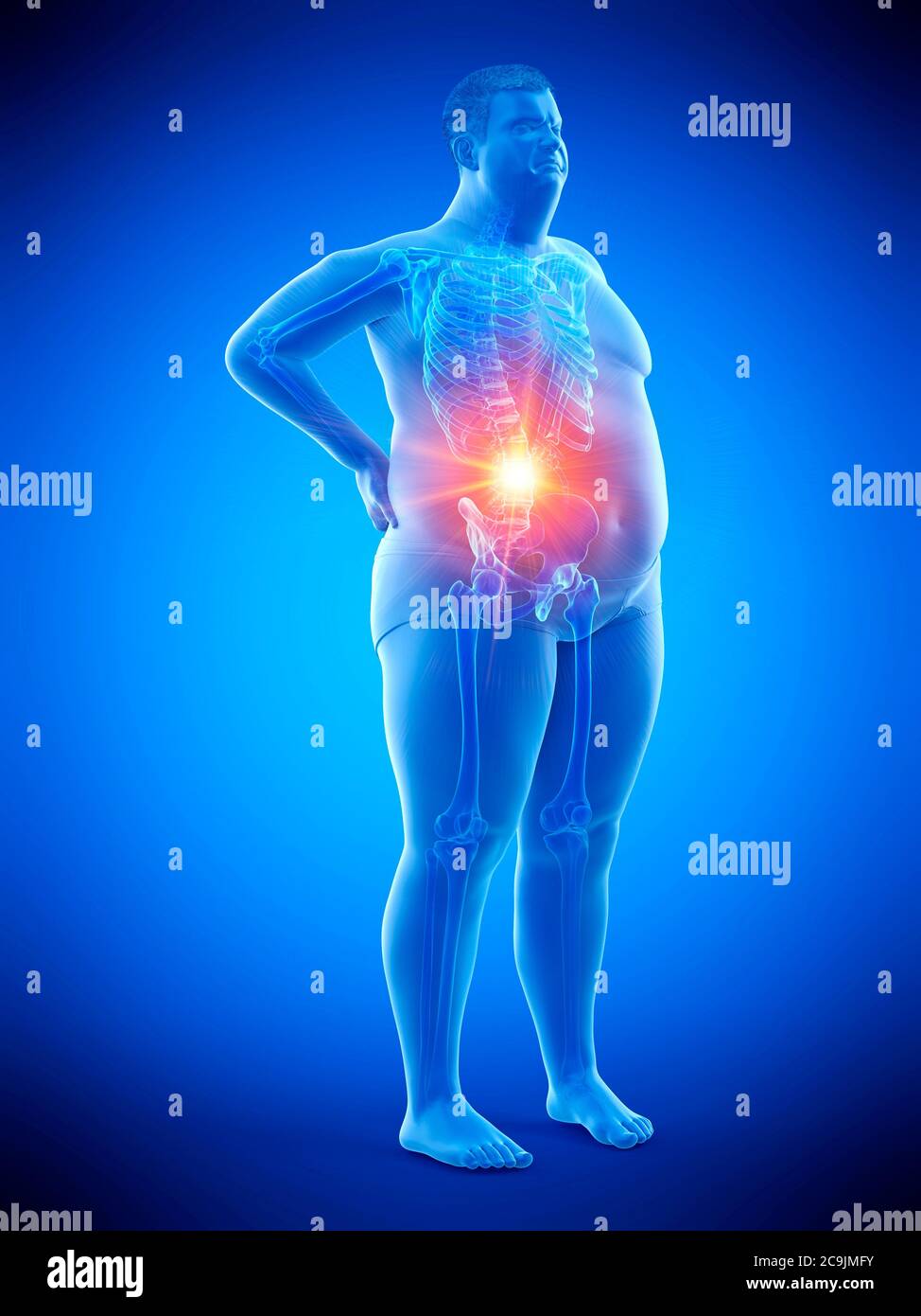 Obese man with back pain hi-res stock photography and images - Alamy