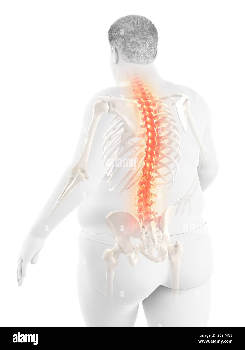 Obese man with back pain, computer illustration Stock Photo - Alamy
