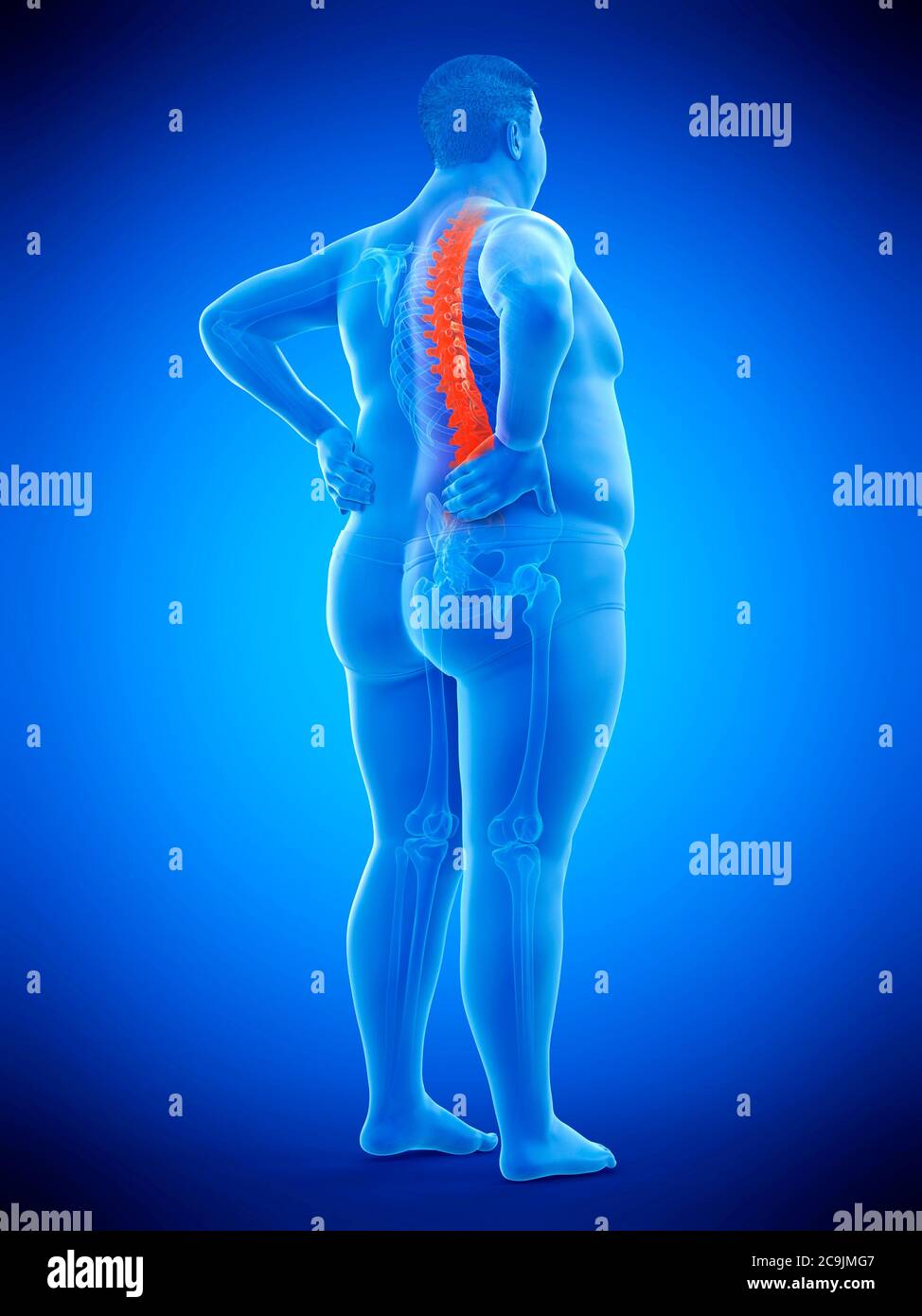 Obese man with back pain, computer illustration Stock Photo - Alamy