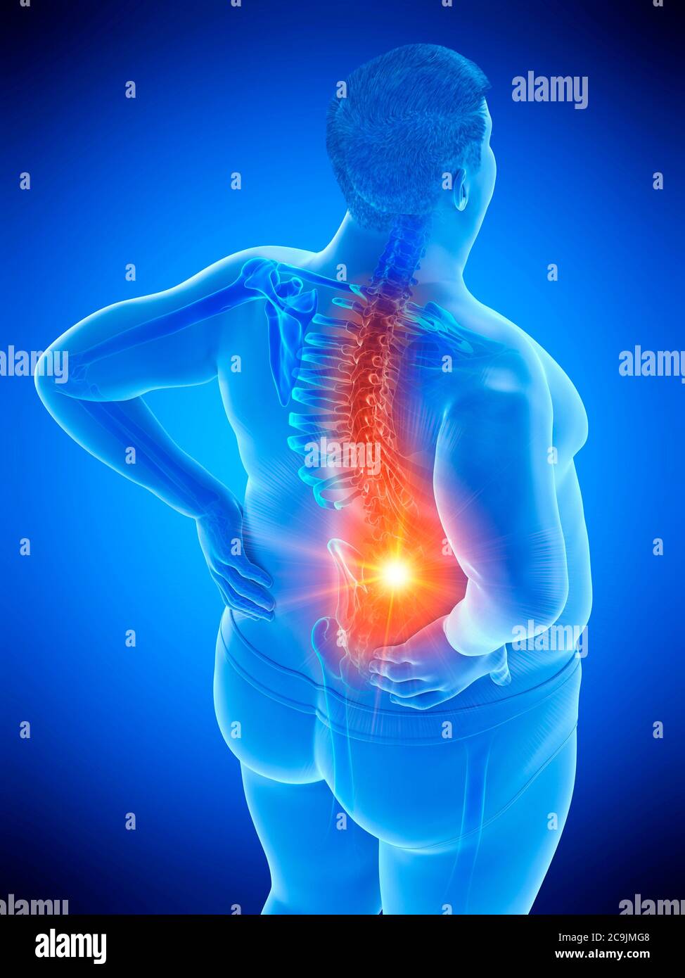 Obese man with back pain, computer illustration Stock Photo - Alamy