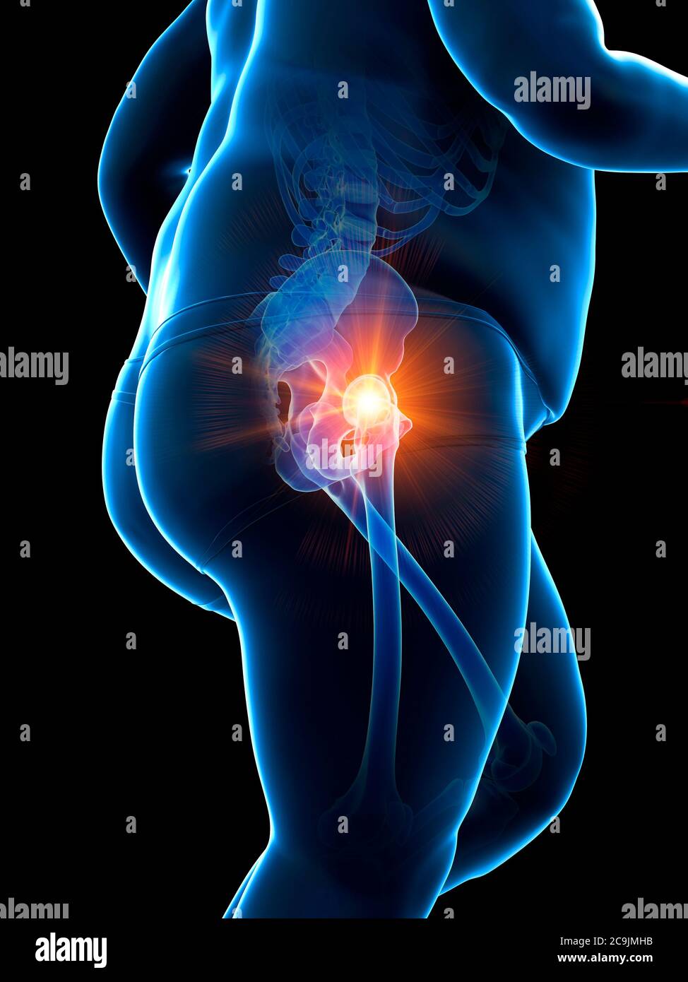 Obese runner with hip pain hi-res stock photography and images - Alamy