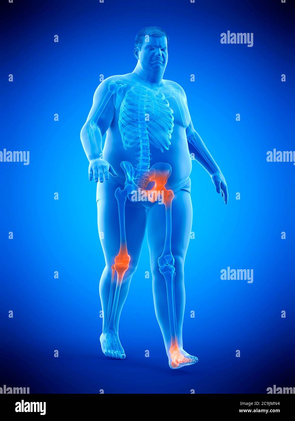 Obese runner with hip pain hi-res stock photography and images - Alamy