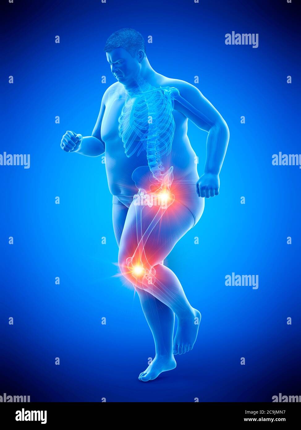 Obese runner with hip pain hi-res stock photography and images - Alamy