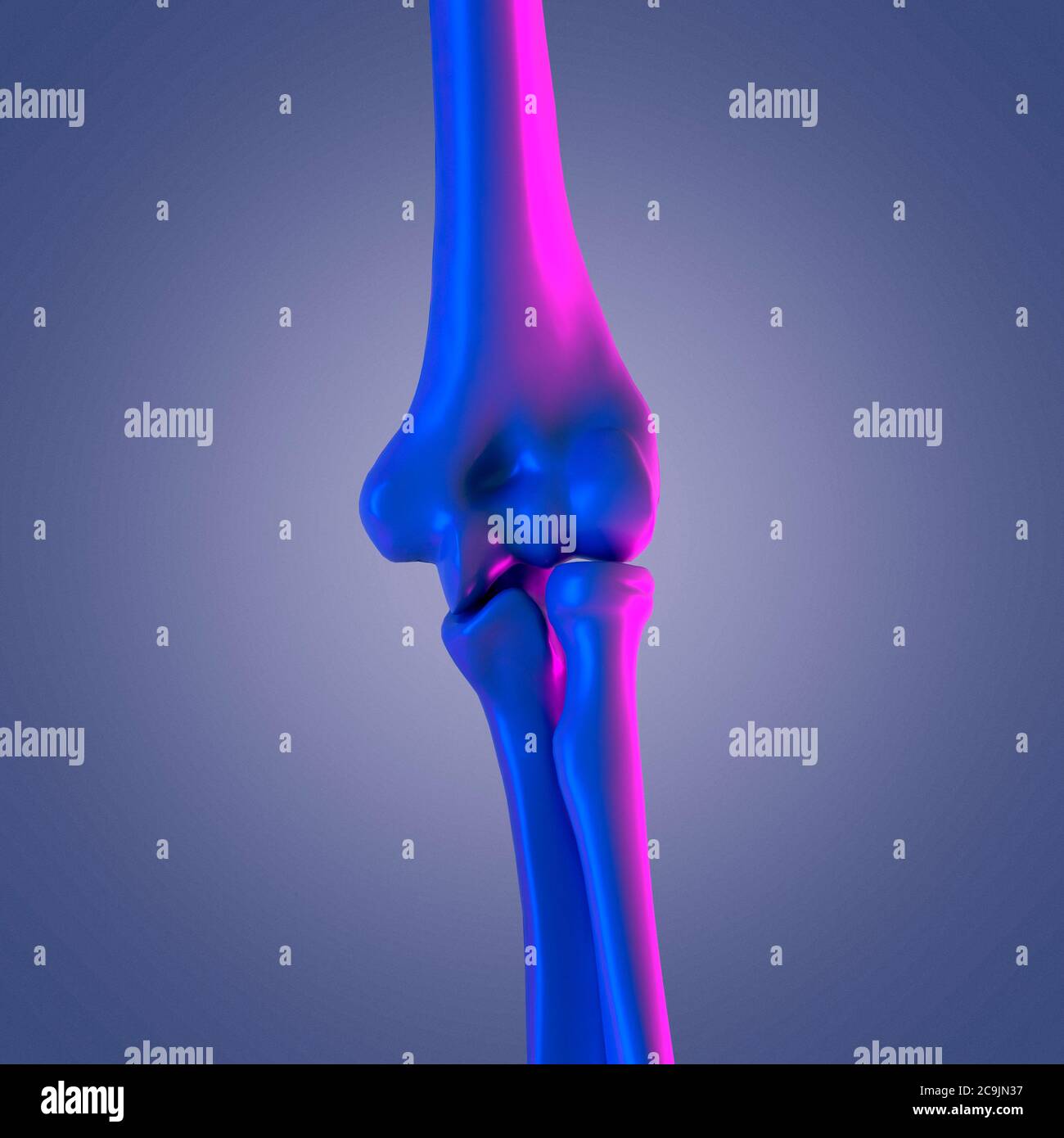 Tennis elbow computer hi-res stock photography and images - Alamy