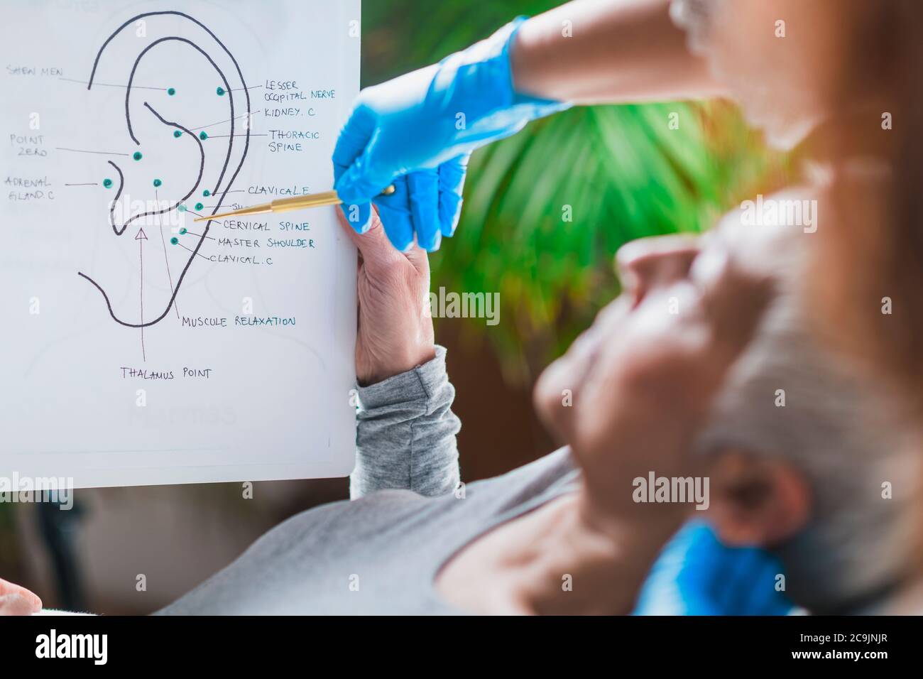 Auriculotherapy hi-res stock photography and images - Alamy