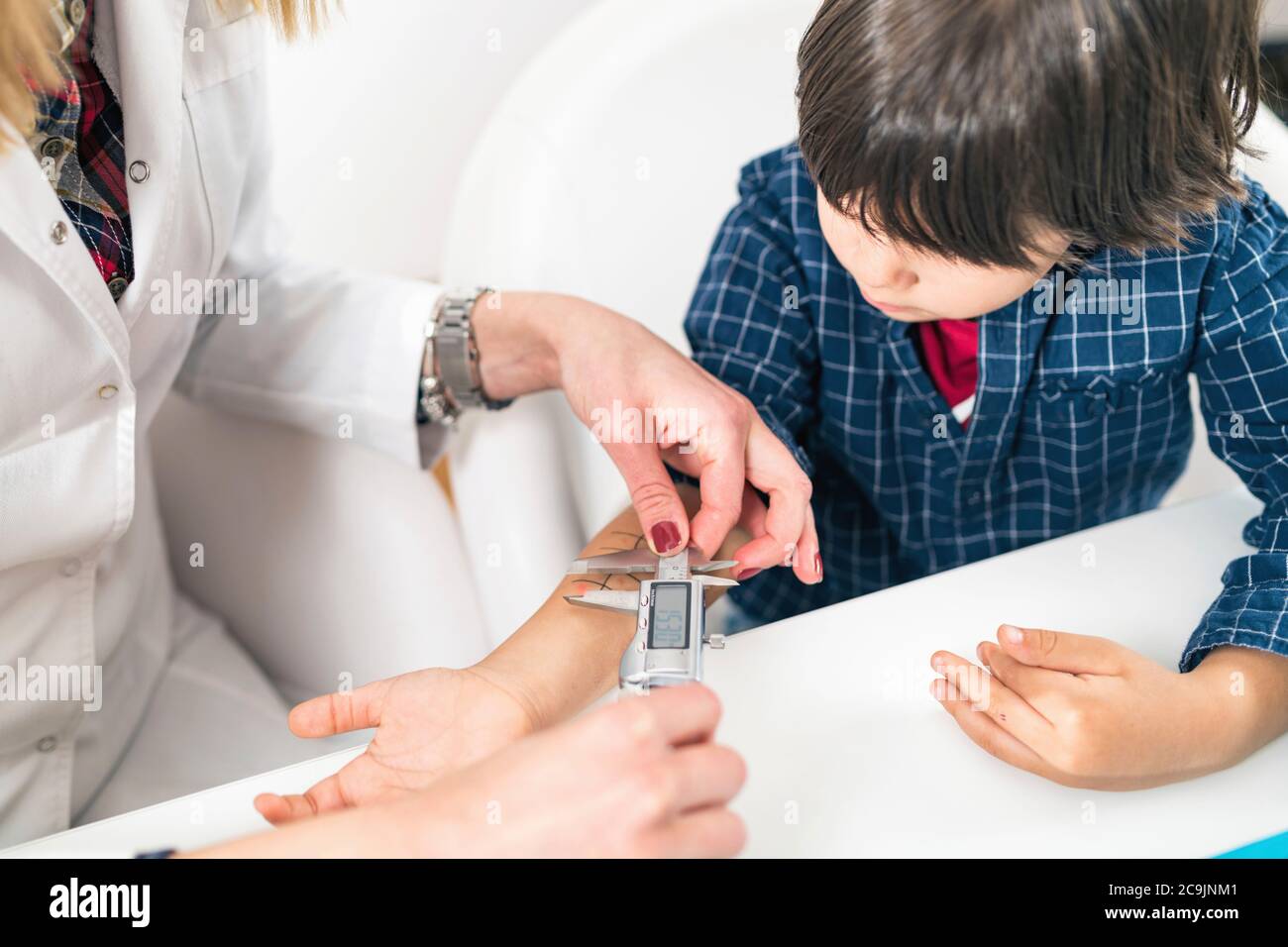 Doctor measuring allergic reaction during skin prick test Stock Photo ...