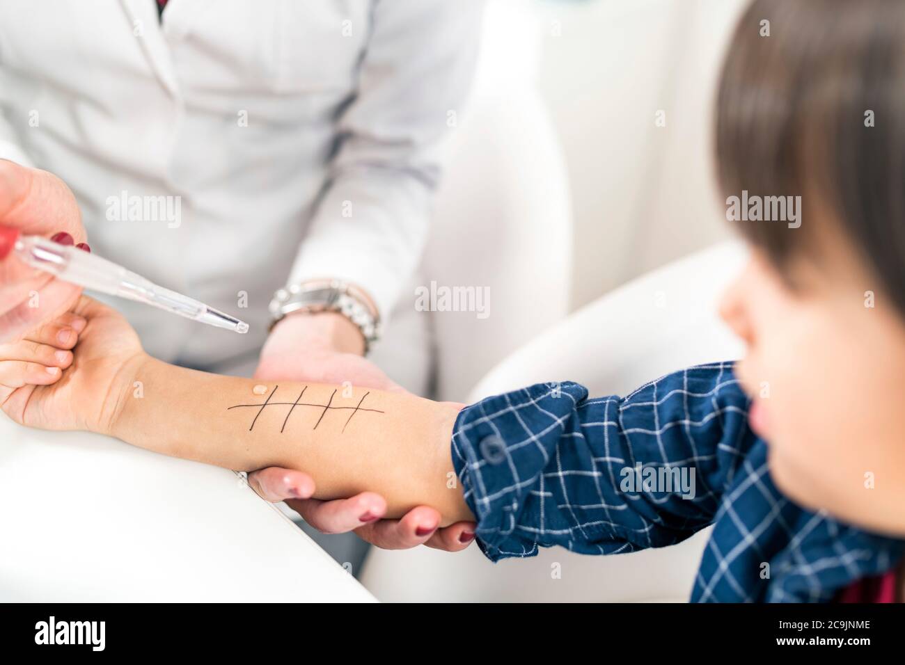 Skin prick allergy testing for children Stock Photo - Alamy