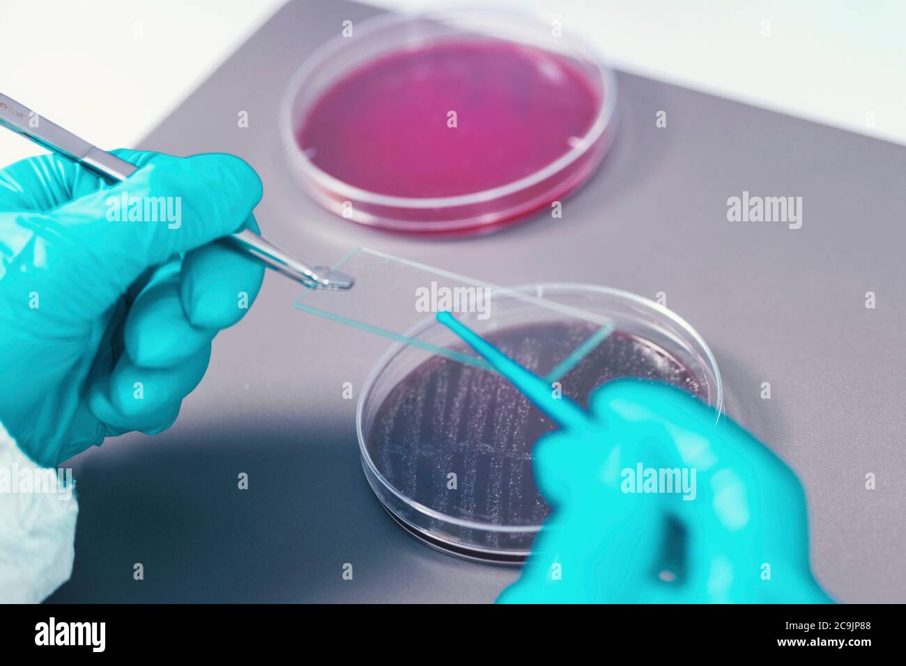 Bacterial sample hi-res stock photography and images - Alamy