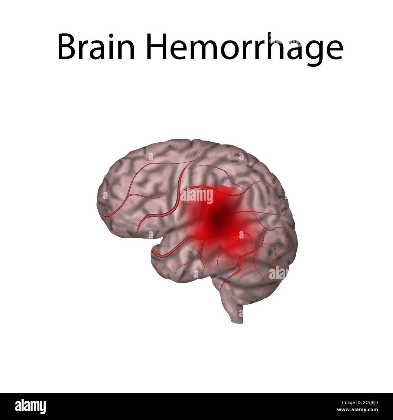 Haemorrhage Logo Novel Targets, Treatments, And Advanced Models For