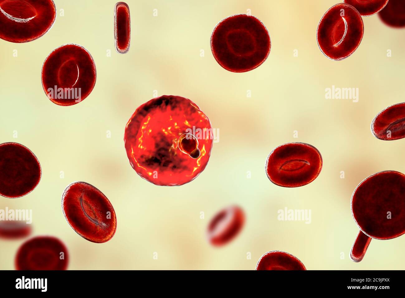 Plasmodium malariae protozoan inside red blood cells, computer ...