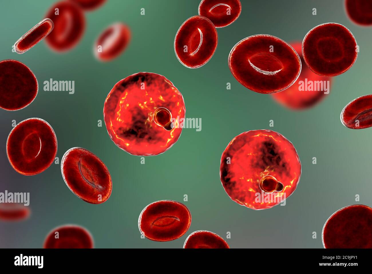 Plasmodium malariae protozoan inside red blood cells, computer ...