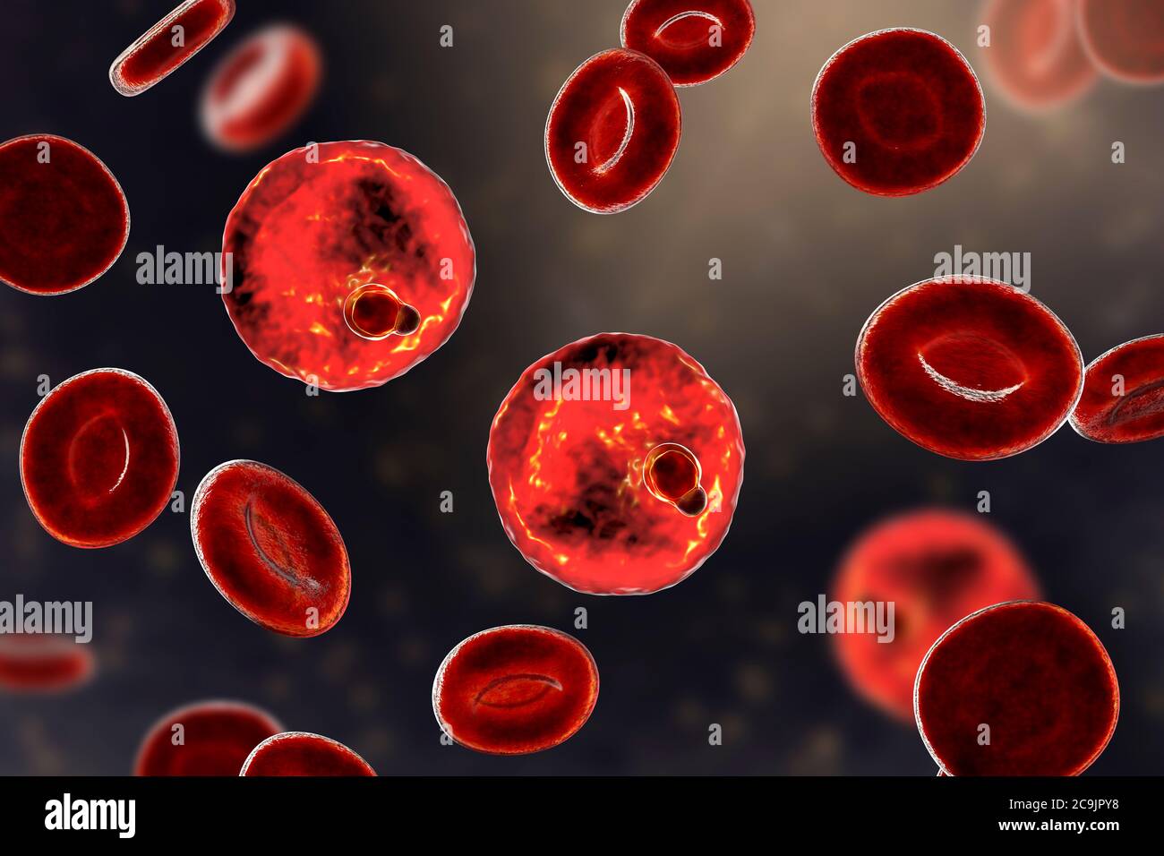Plasmodium malariae protozoan inside red blood cells, computer ...