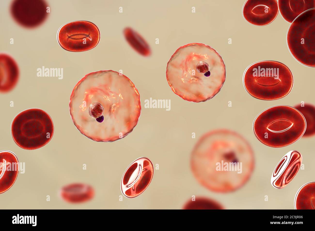Plasmodium malariae protozoan inside red blood cells, computer ...