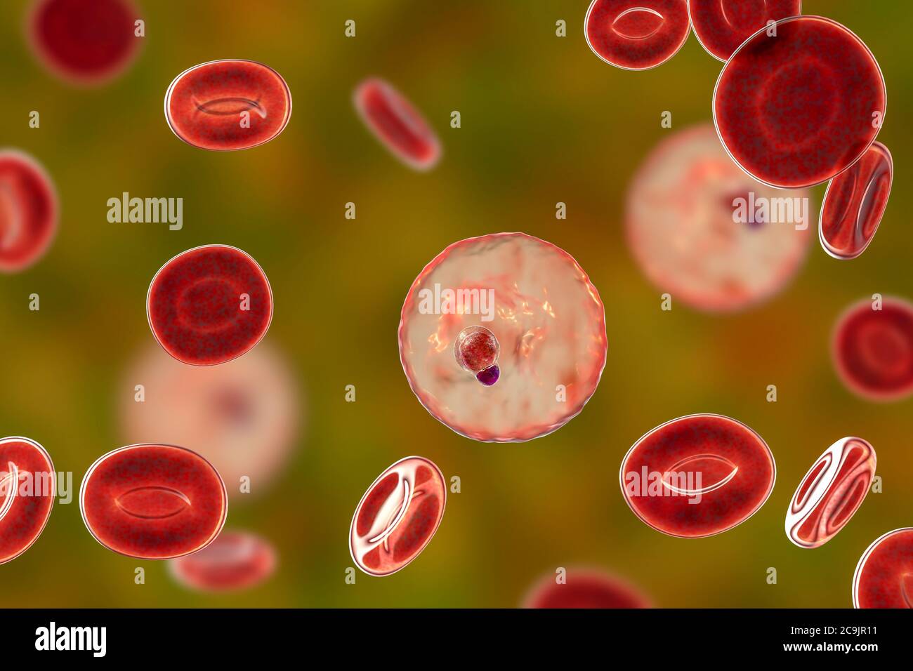 Plasmodium malariae protozoan inside red blood cells, computer ...