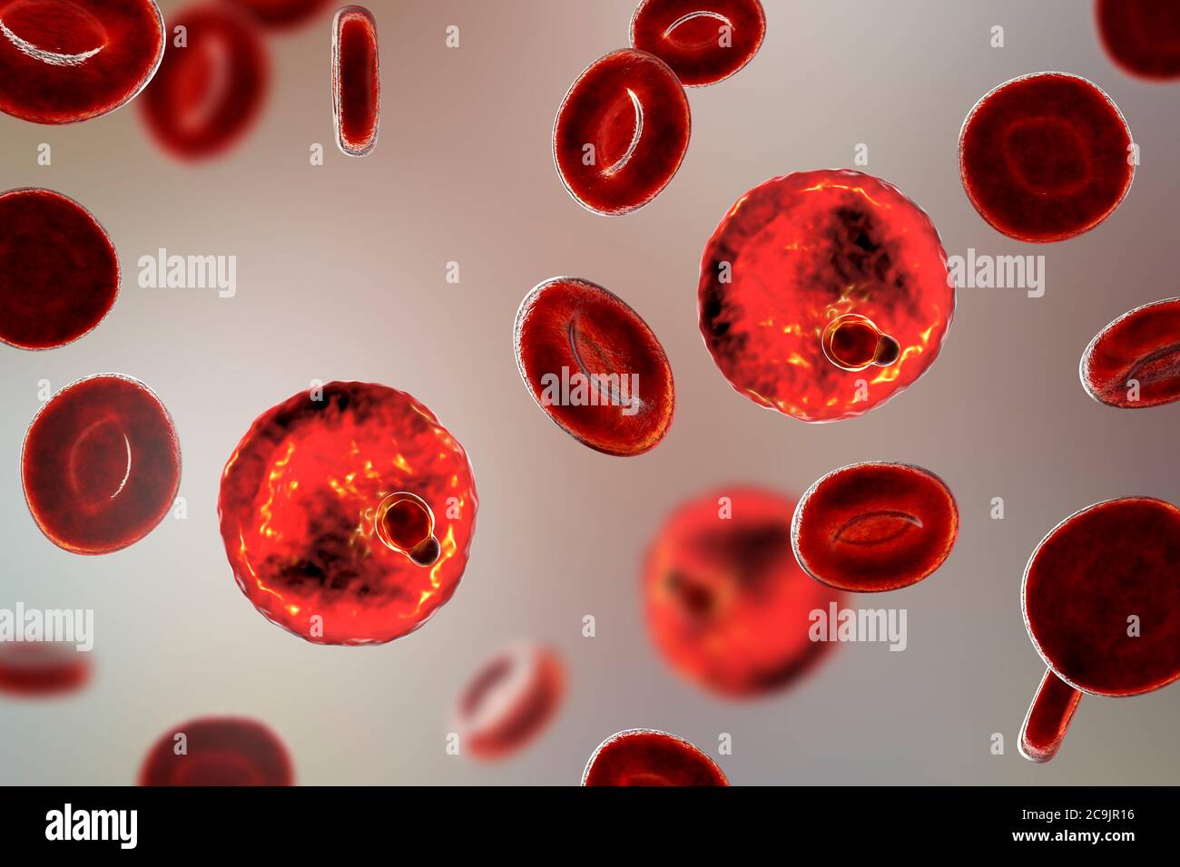 Plasmodium malariae protozoan inside red blood cells, computer ...
