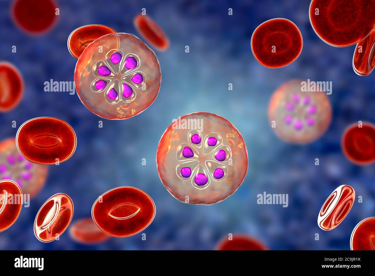Plasmodium malariae protozoan inside red blood cells, computer ...