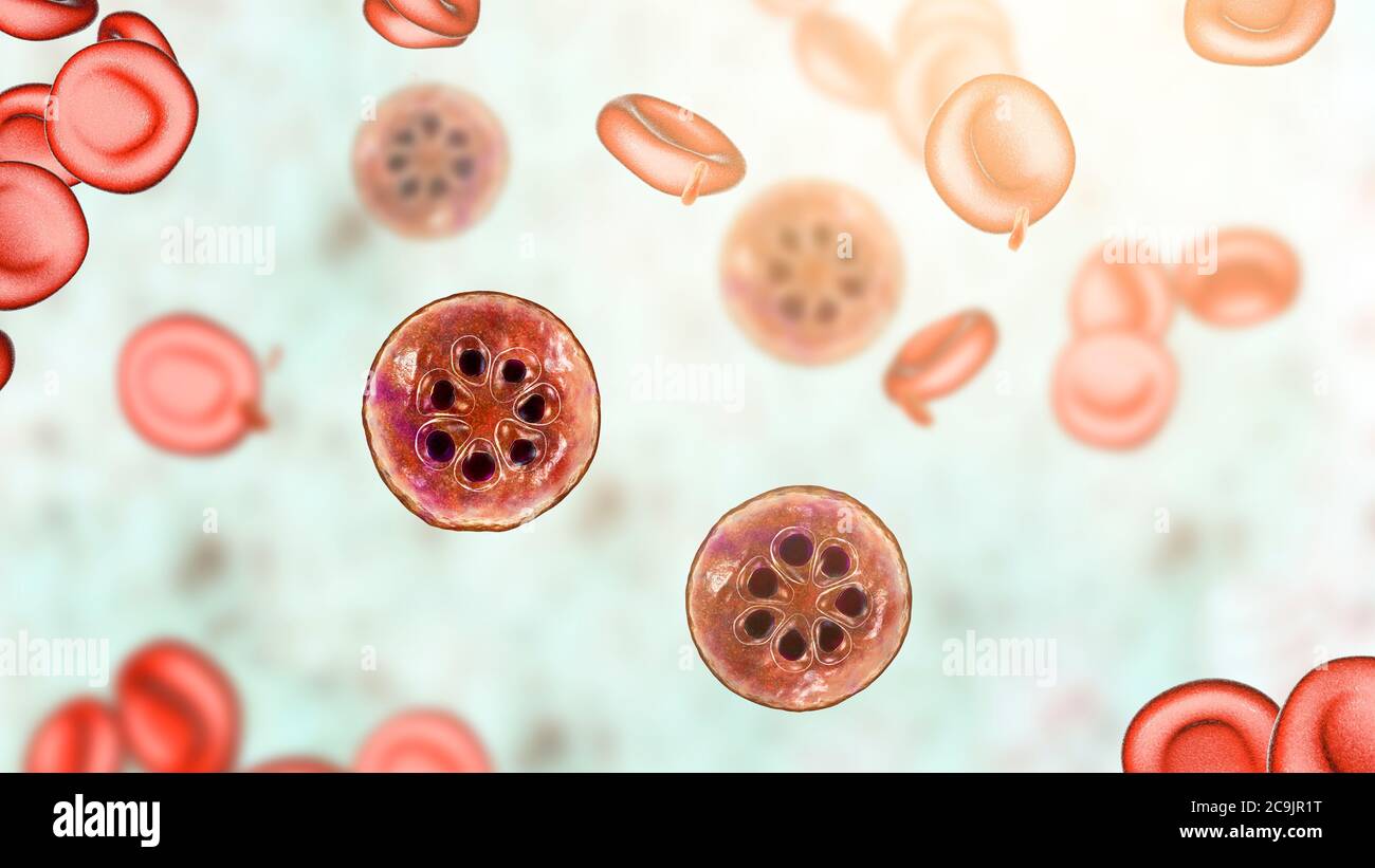 Plasmodium malariae protozoan inside red blood cells, computer ...