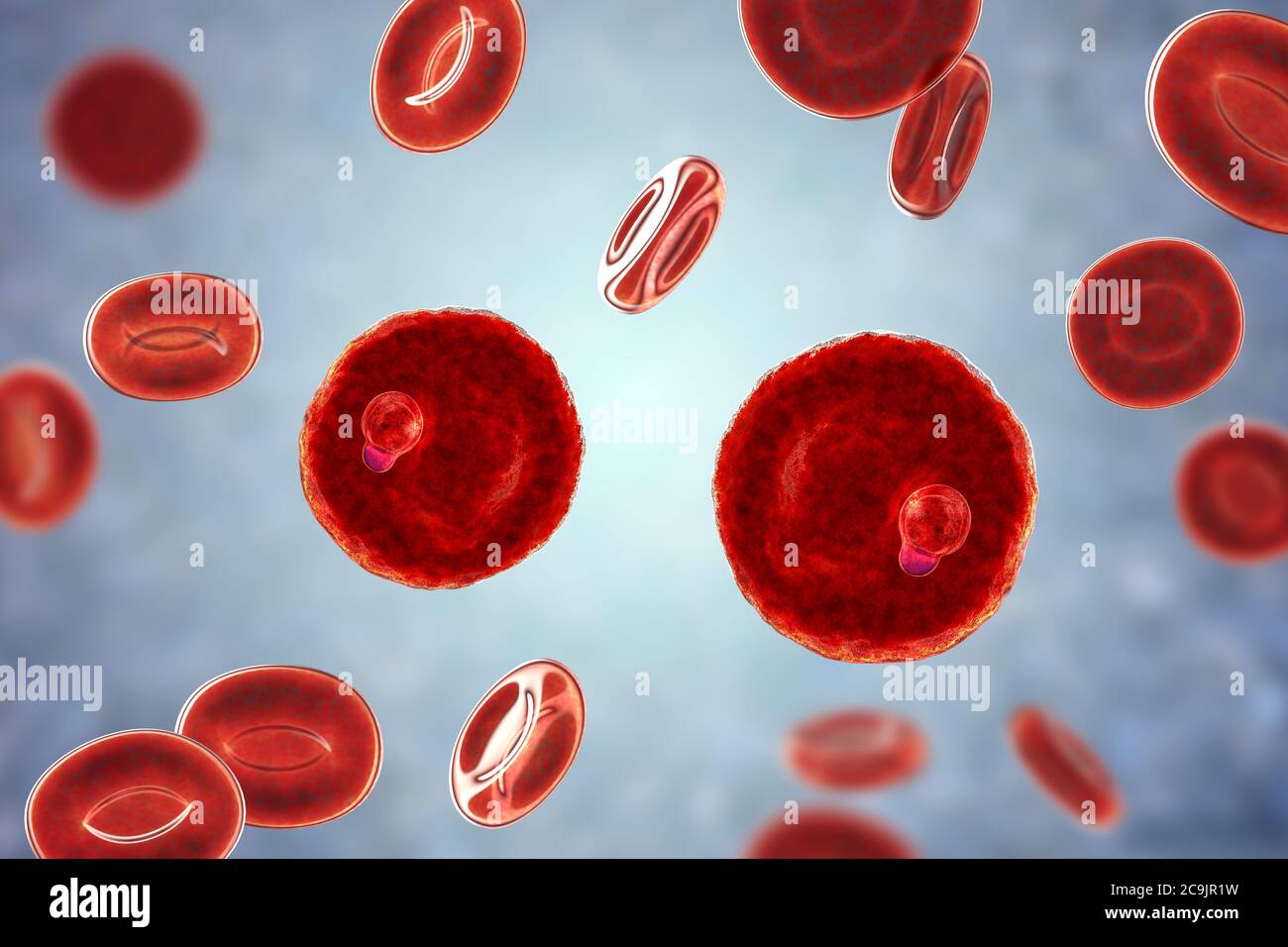 Plasmodium malariae protozoan inside red blood cells, computer ...