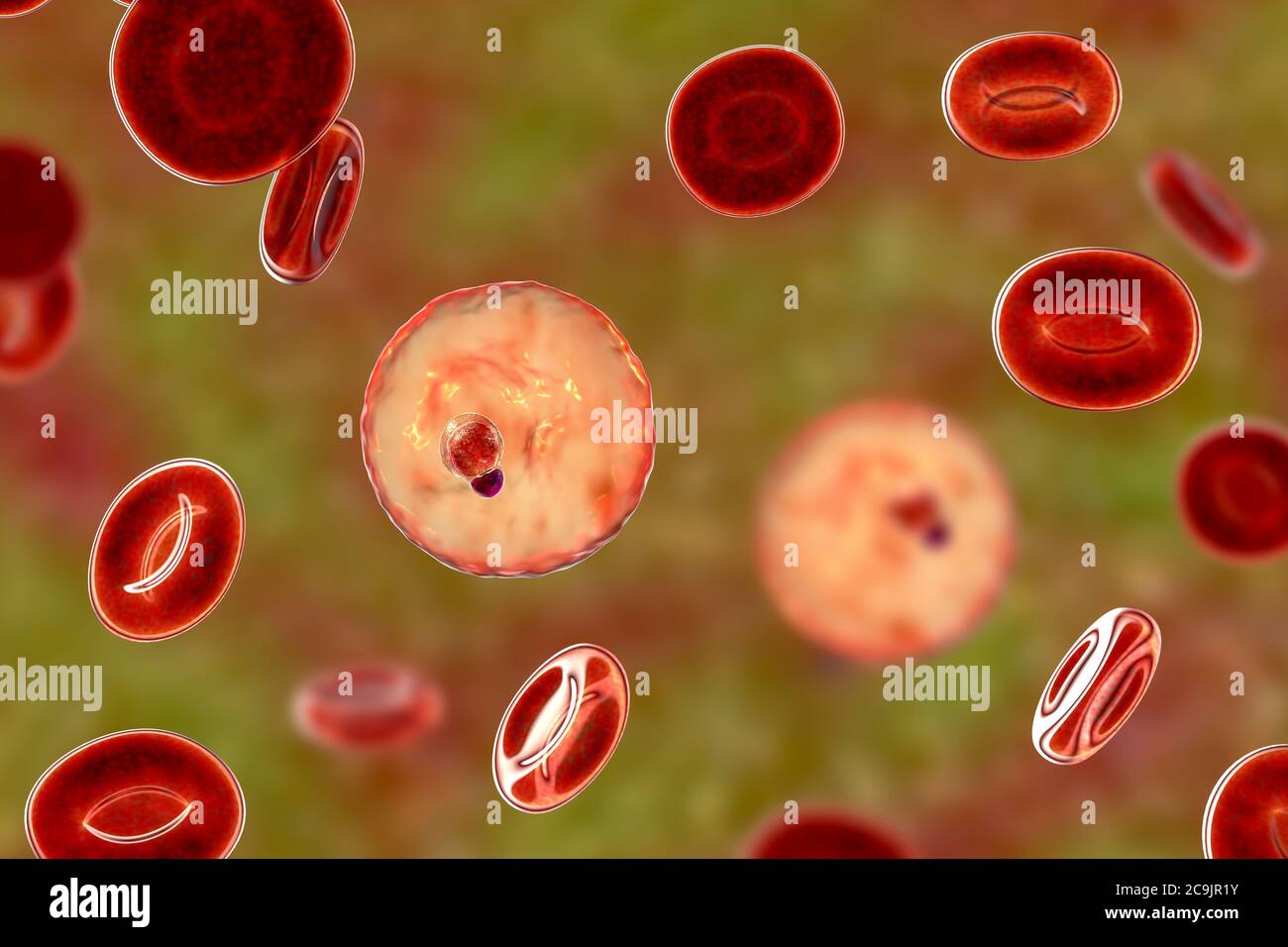 Plasmodium malariae protozoan inside red blood cells, computer ...