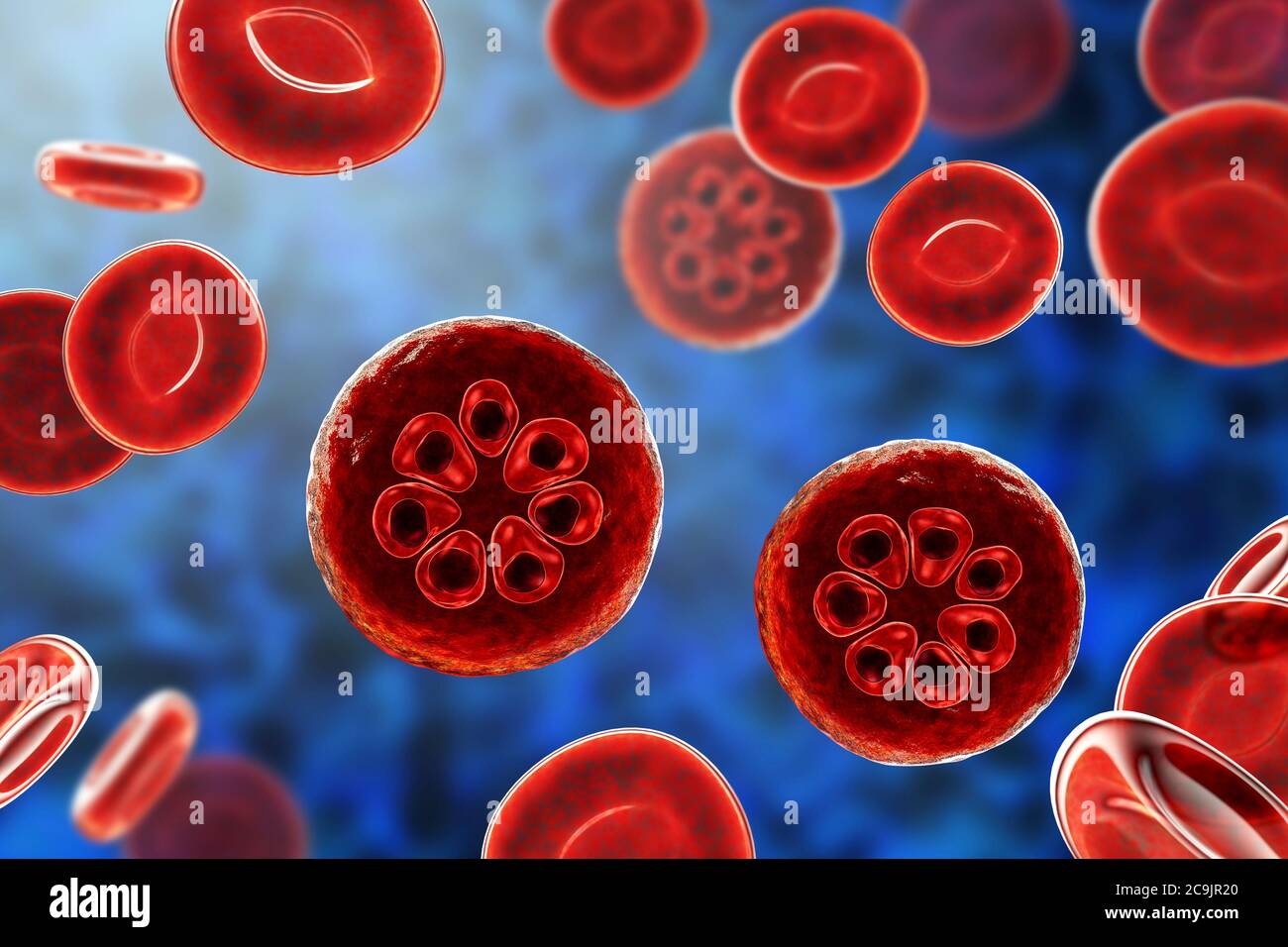 Plasmodium malariae protozoan inside red blood cells, computer ...