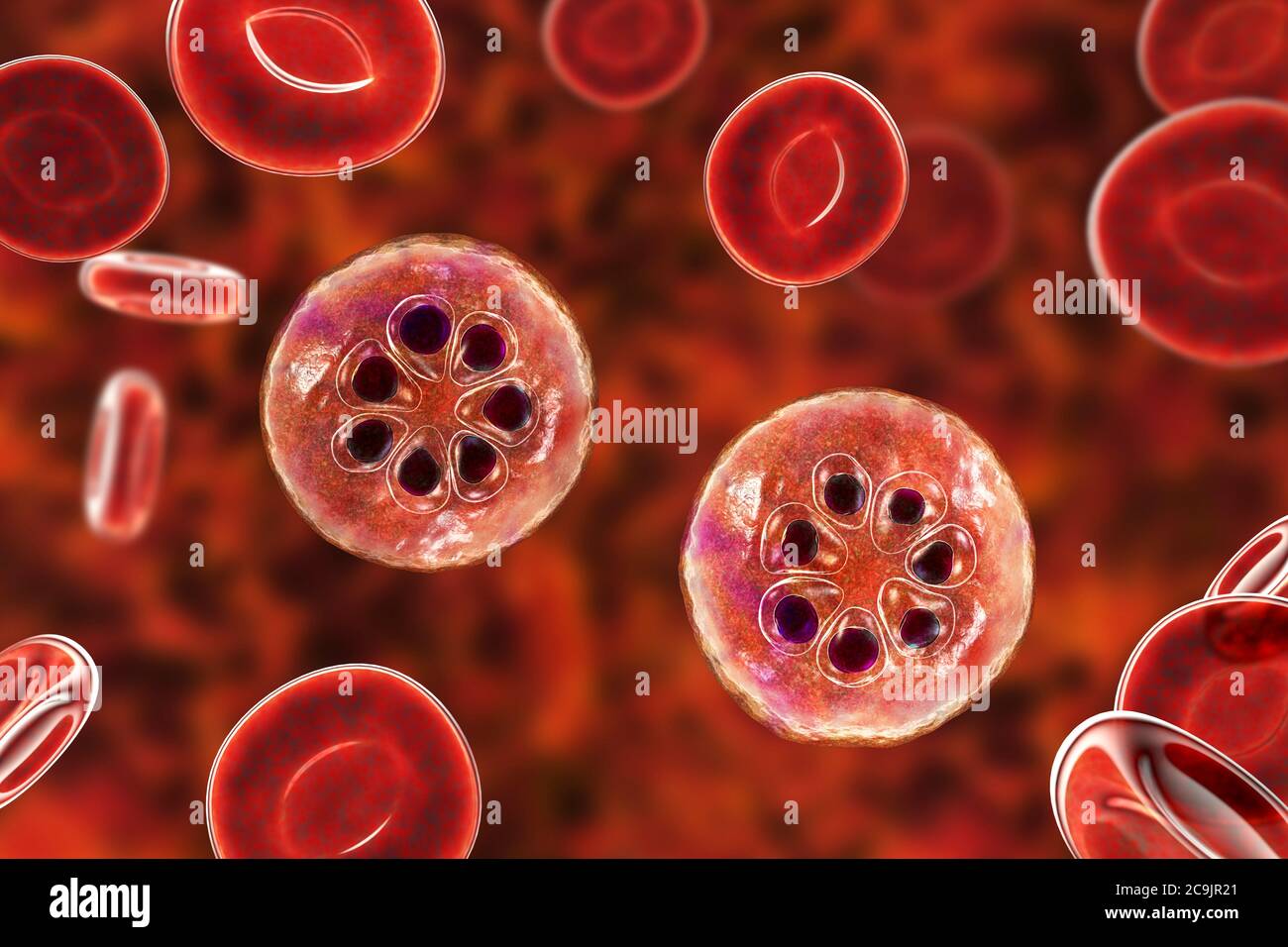 Plasmodium malariae protozoan inside red blood cells, computer ...