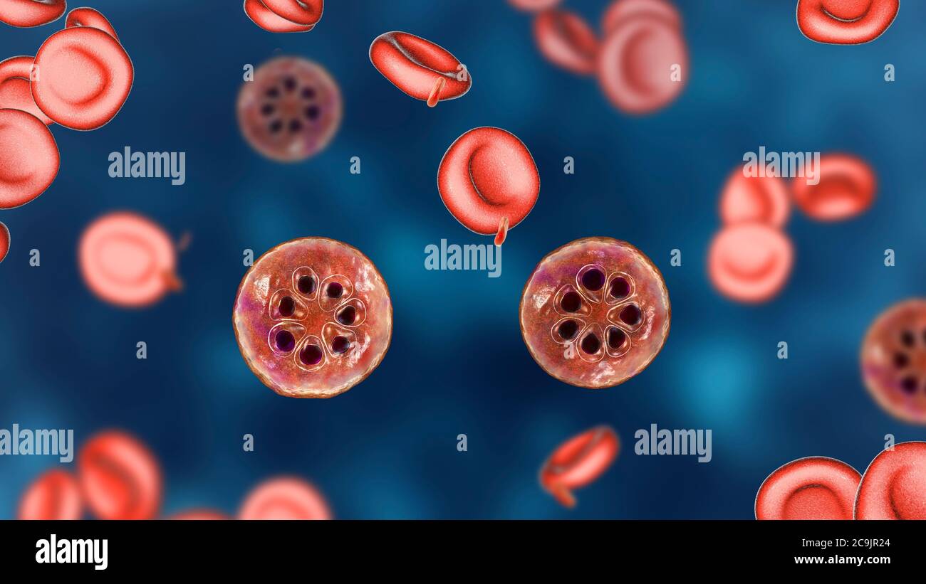 Plasmodium malariae protozoan inside red blood cells, computer ...