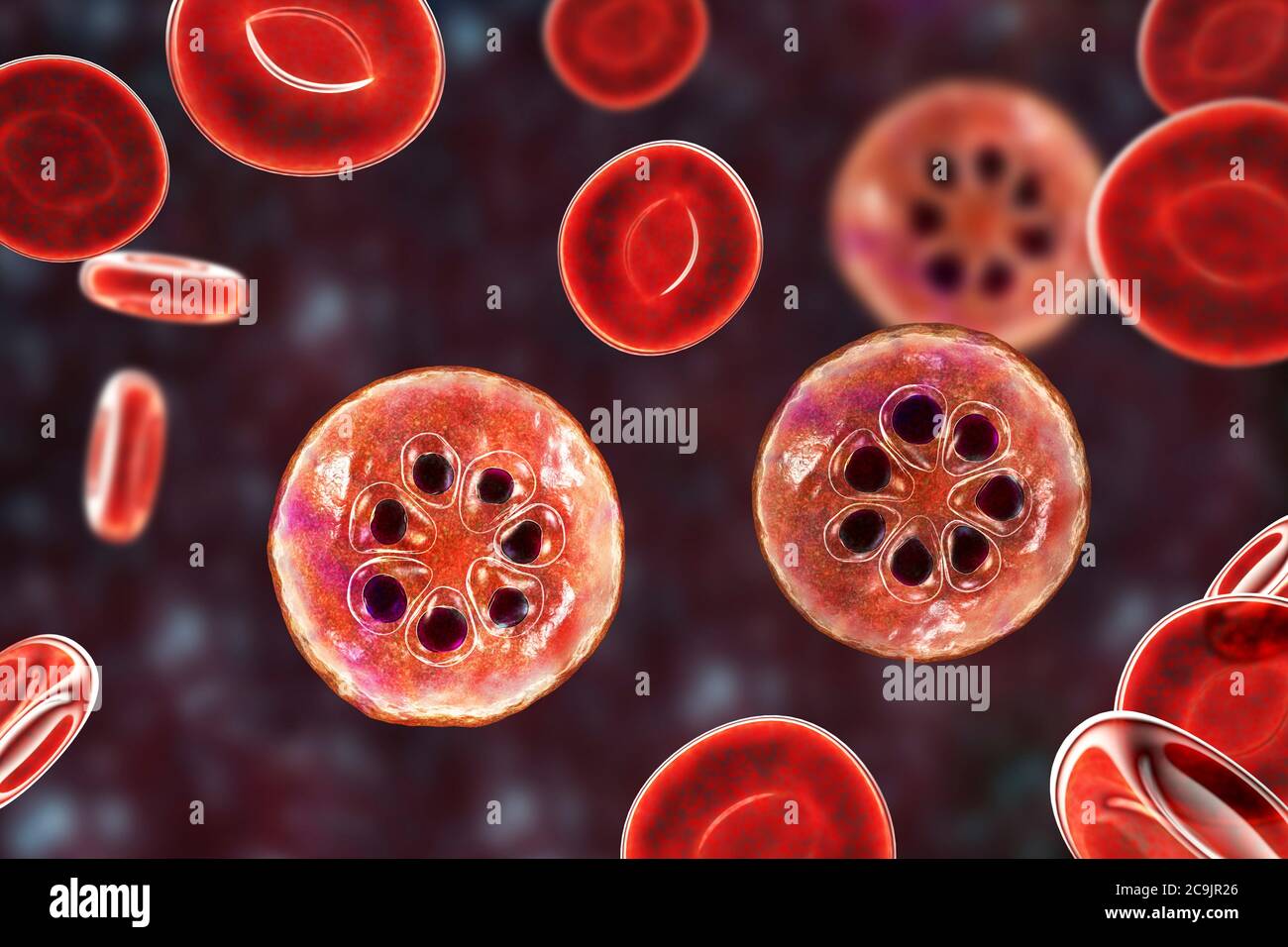 Plasmodium malariae protozoan inside red blood cells, computer ...