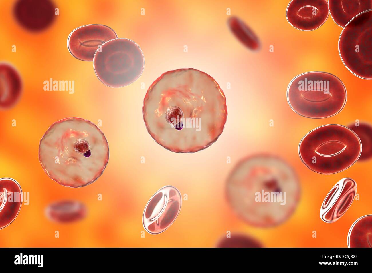 Plasmodium malariae protozoan inside red blood cells, computer ...