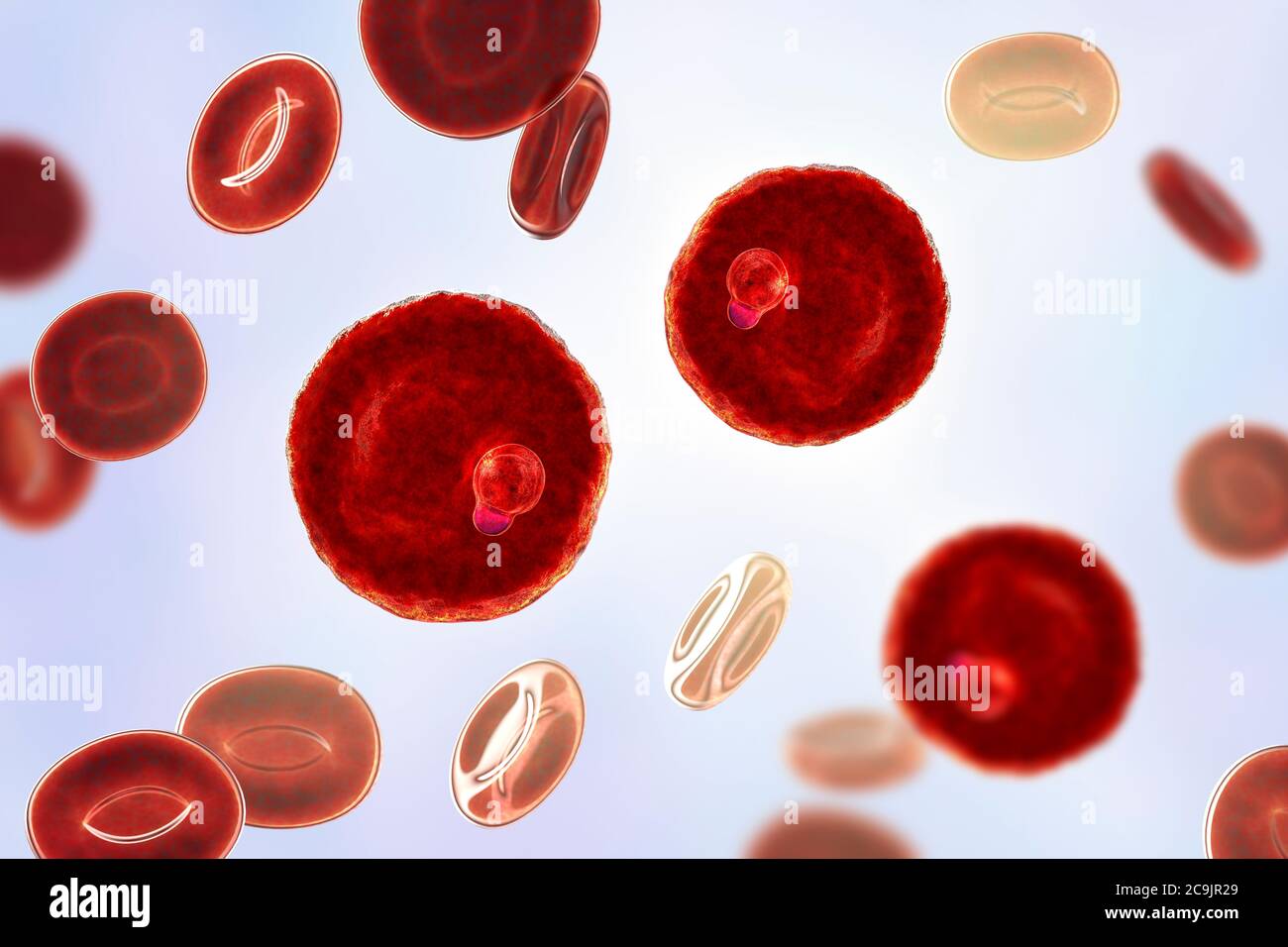 Plasmodium malariae protozoan inside red blood cells, computer ...