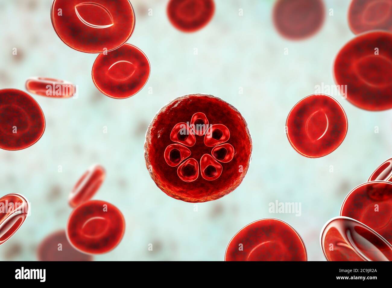 Plasmodium malariae protozoan inside red blood cells, computer ...