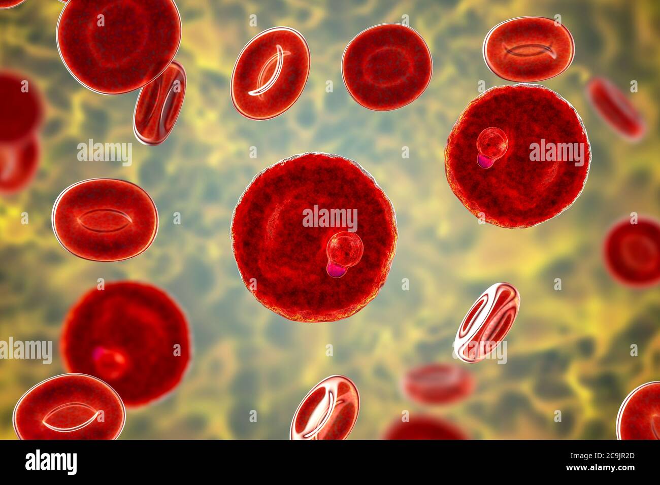 Plasmodium malariae protozoan inside red blood cells, computer ...