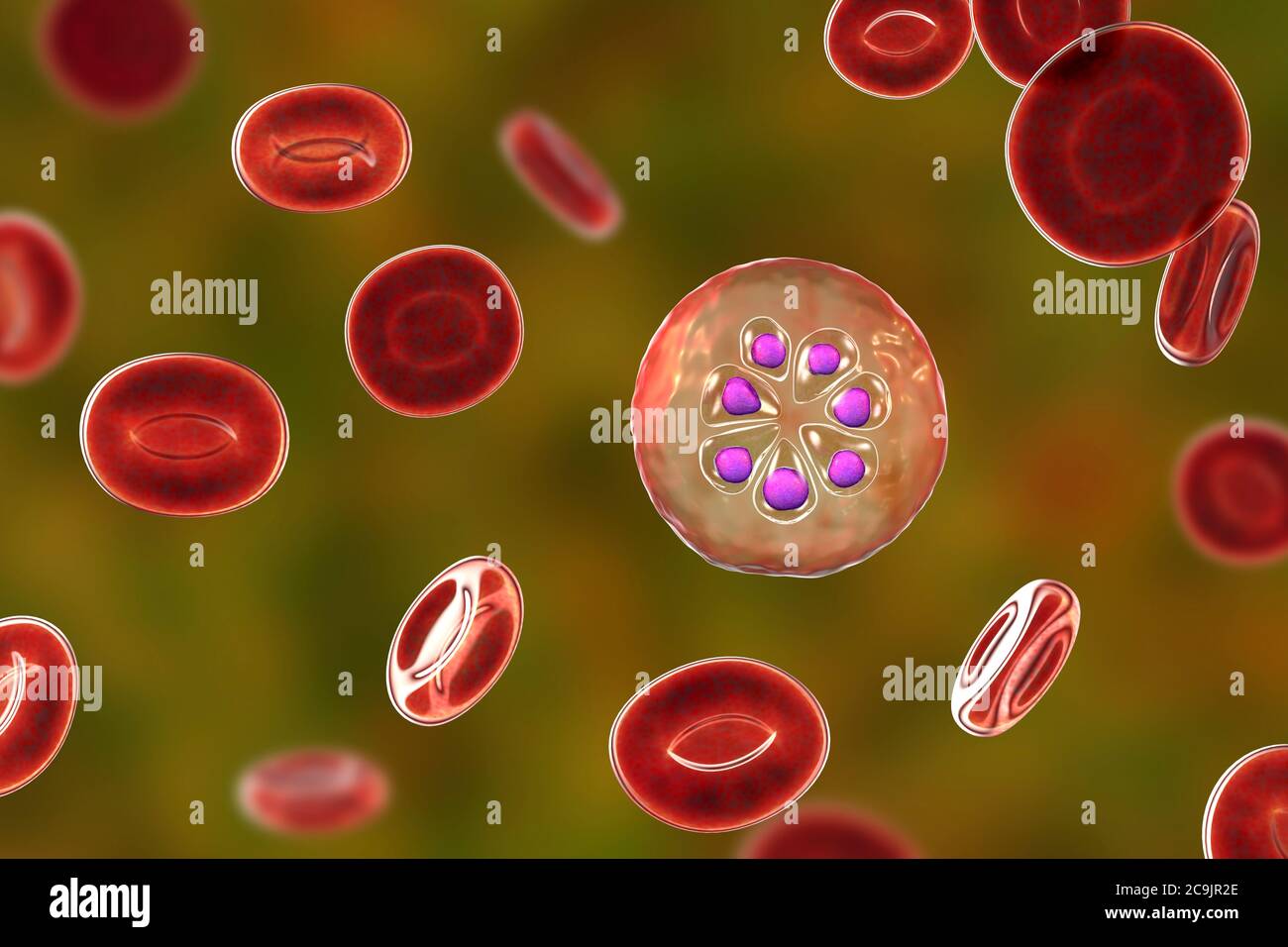 Plasmodium malariae protozoan inside red blood cells, computer ...