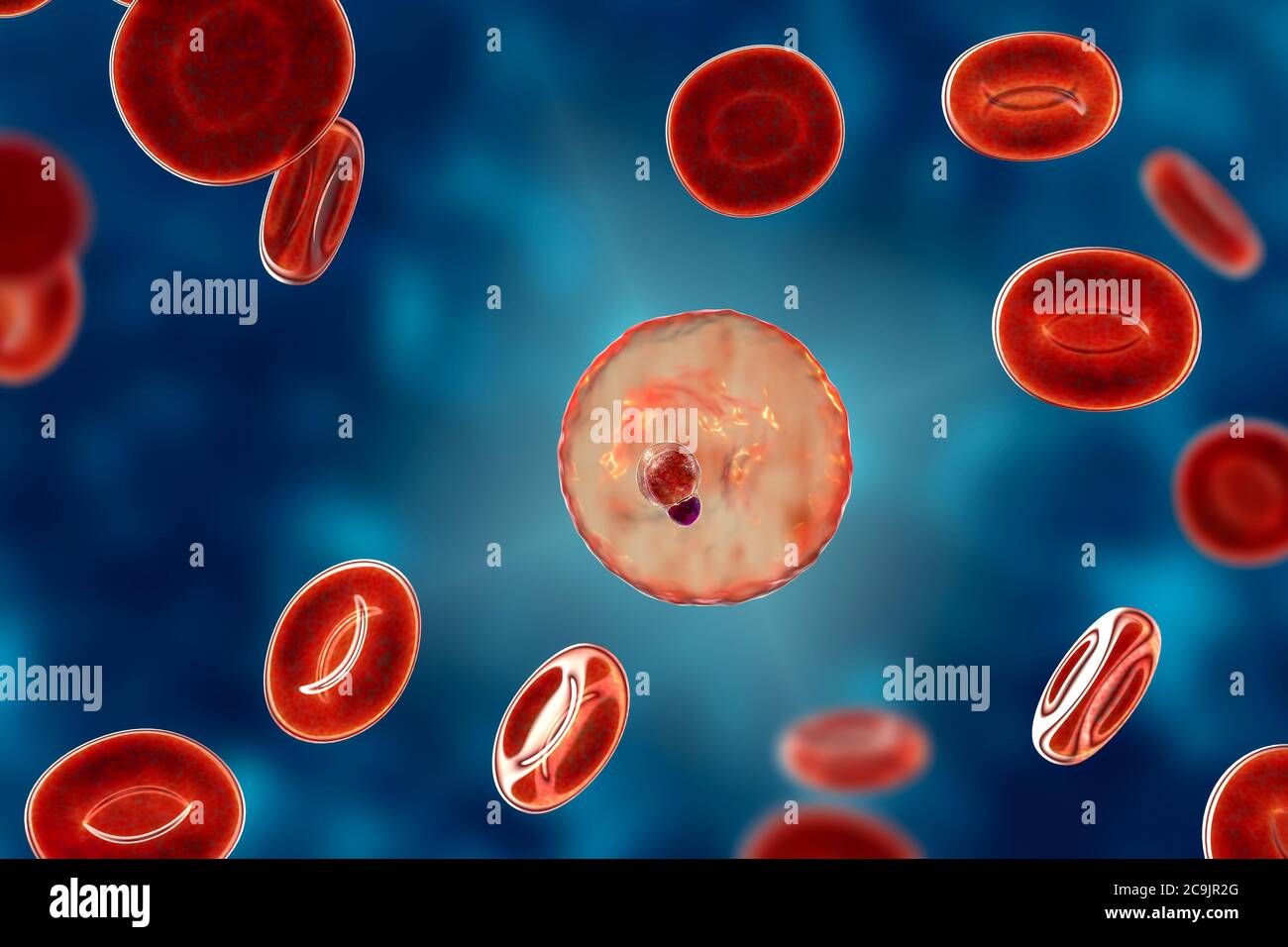 Plasmodium malariae protozoan inside red blood cells, computer ...