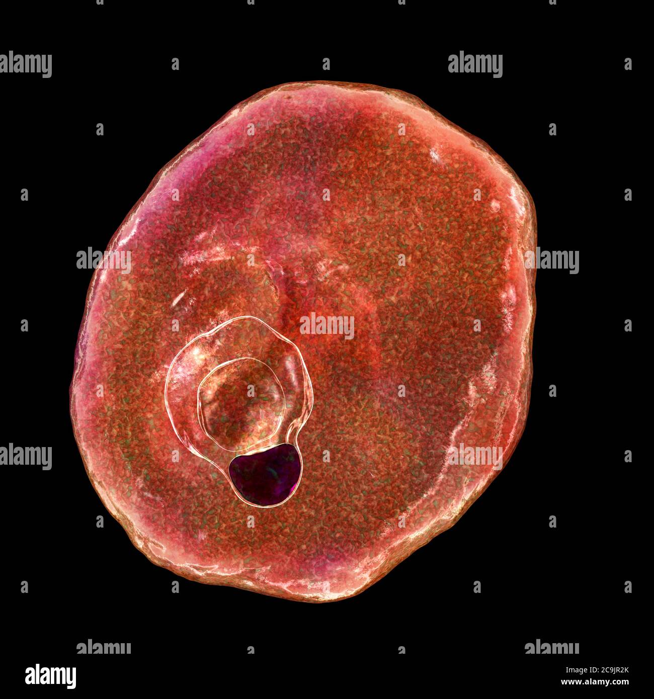 Plasmodium ovale protozoan inside red blood cell, computer illustration ...